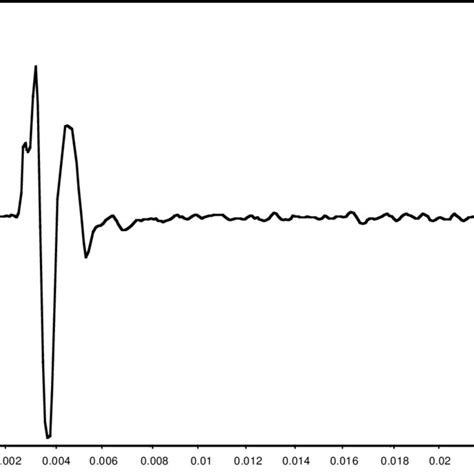 A Representative Example Of A Spontaneous Spike Discharge Recorded
