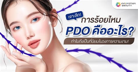 เจาะลึก การร้อยไหม pdo polydioxanone คืออะไร ทำไมถึงเป็นที่นิยม