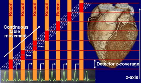 Cardiac Ct How Much Can Temporal Resolution Spatial Resolution And Volume Coverage Be