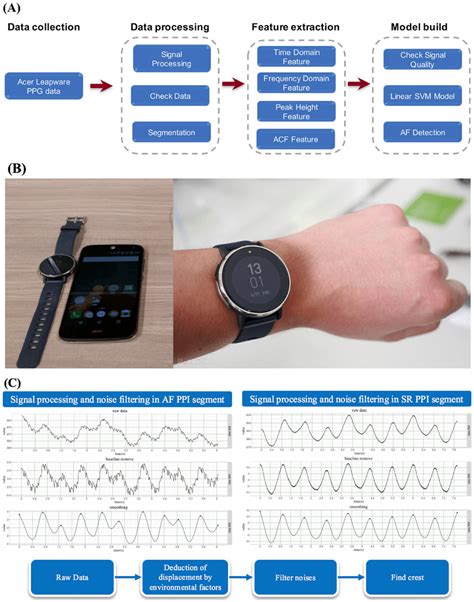 A Proposed Framework Of The Photoplethysmogram Ppg To Detect Atrial Download Scientific