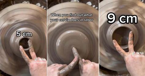 Innovative Demonstration Shows How Much Cervix Dilates During