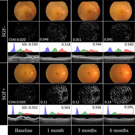 typical color fundus photographs and corresponding adaptive download scientific diagram