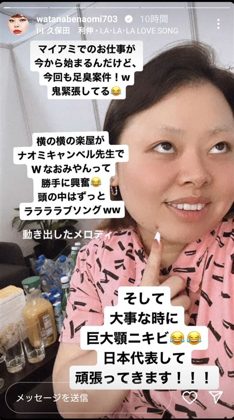 20キロ減・渡辺直美、スッピンのアゴに巨大ニキビ！…超ミニ丈で引き締まった足チラが「かわいい」と話題 スポーツ報知