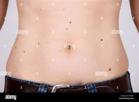 Freckles On Stomach 13 Causes Of Red Spots On Skin Jwez