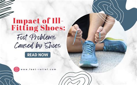 Shoes For Feet Problem At Yvonne Park Blog