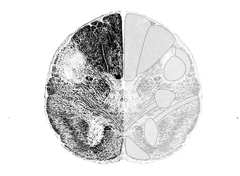 Довгастий мозок Енциклопедія мозку