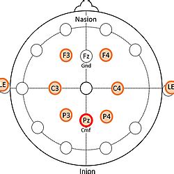 Scalp Electrode Placement