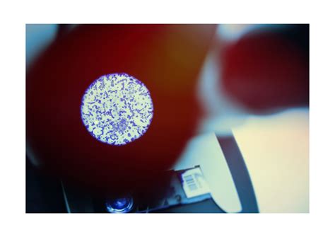 Gonorrhoea Symptoms Testing And Treatment Std Clinic