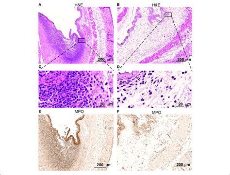 Skin Infiltrates Increase When In Contact With S Aureus Xen29