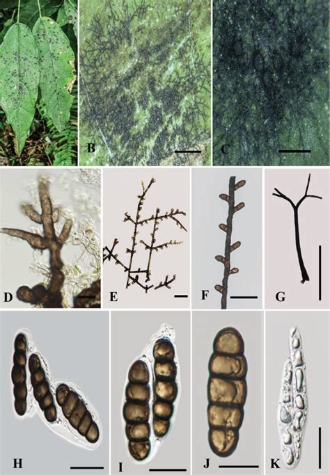 two New Species Of Meliola From Yunnan Province China Pmc
