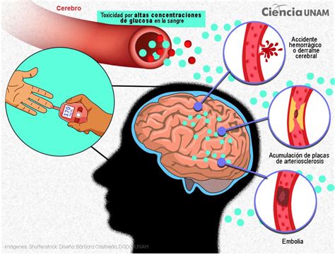 Cómo La Diabetes Pone En Peligro Al Cerebro De Reporteros