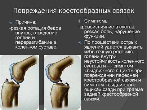Повреждения и заболевания коленного сустава презентация онлайн