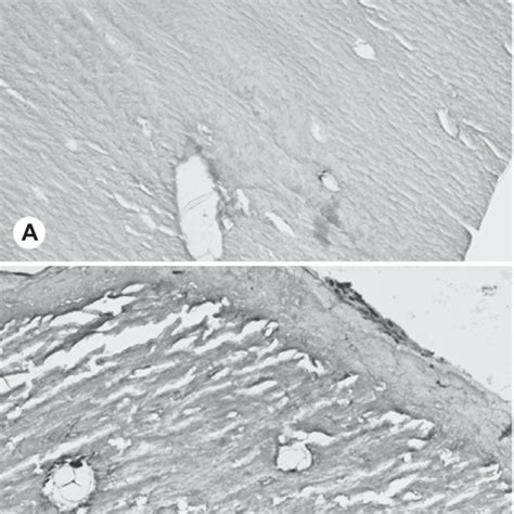 Technical Schemes Of Representative Ossicular Replacement Prosthesis