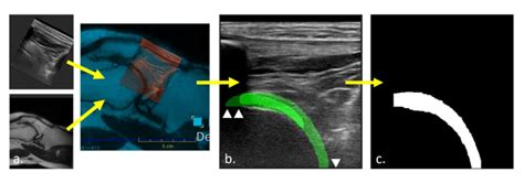 Summary Of The Procedure To Create The Mri Based Pseudo Ground Truth