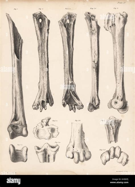 Tibia And Metatarsus Of The Extinct Rodrigues Solitaire Pezophaps