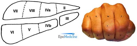 Liver Segments Explained With Mnemonic Epomedicine