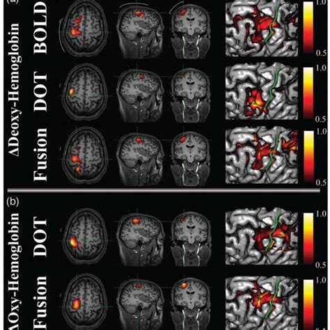 Diffuse Optical Tomography Diffuse Optical Tomography Uses Download Scientific Diagram