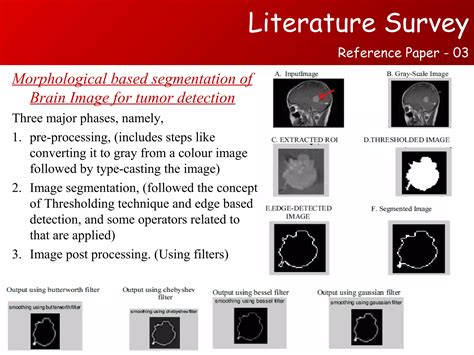 Brain Tumor Detection By Scanning Mri Images Using Filtering Techniques Ppt