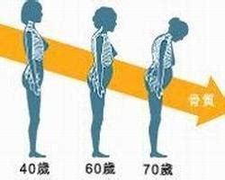 骨质软化症 搜狗百科
