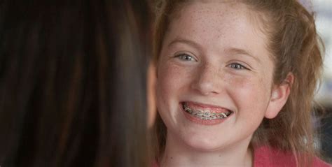 Everything You Need To Know About Rubber Bands For Braces Greater Northwest Orthodontics