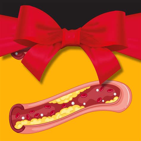 Ateroskleróza Dárkový Voucher Vaše Laboratoře