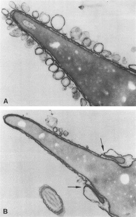 Transmission Electron Micrograph Of Acrosome Reacted Human Spermatozoa Download Scientific