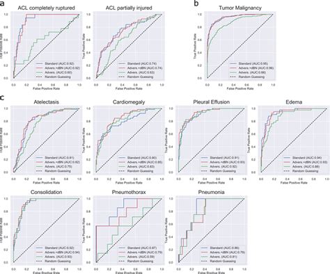 The Usage Of Dual Batch Norm Boosts The Classification Performance Of Download Scientific