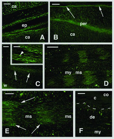 immunofluorescence of differentiating tissues in proximal areas of
