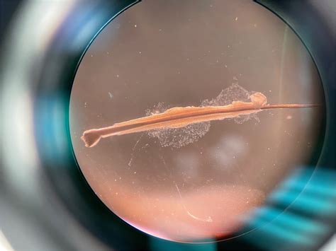 Why We Bank The Hair Follicle Acorn Blog