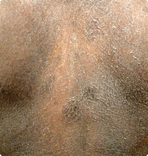 Ctcl Staging Tool Probe In Ctcl