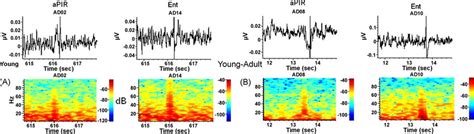 Typical Examples Of Lfp Time Series And Their Respective Spectrograms