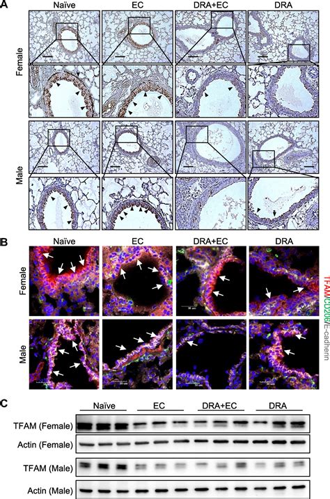 Sex Specific Lung Inflammation And Mitochondrial Damage In A Model Of