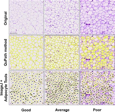 Comparison Of The Ability Of Qupath And Imagej Plugin Adipocyte Tools Download Scientific