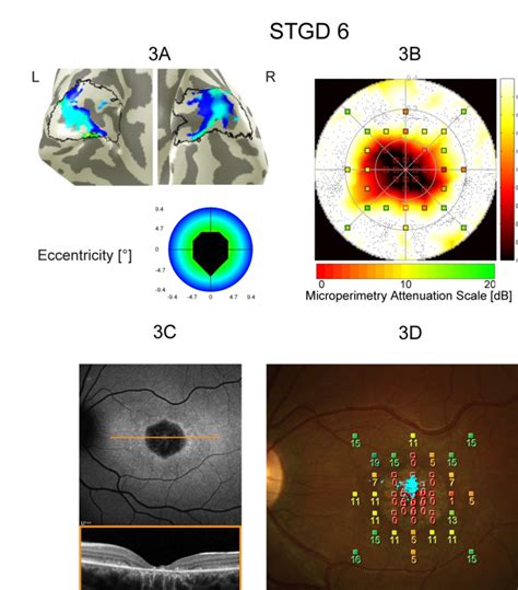 Correspondence Between Retinotopic Cortical Mapping And Conventional