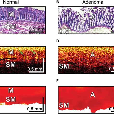Examples Of Morphological Examination Of Normal Colon A C E And