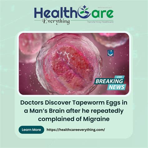 Healthcare Everything On Linkedin Doctors Discover Tapeworm Eggs In A
