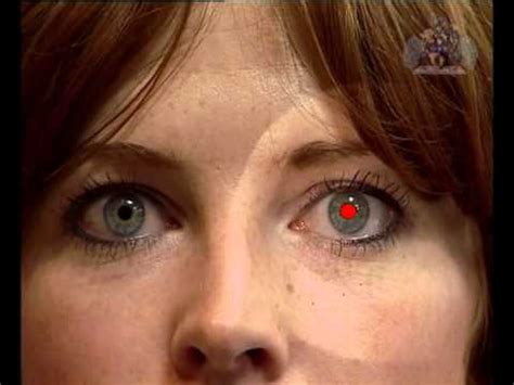 Ophthalmoscopy Video YouTube