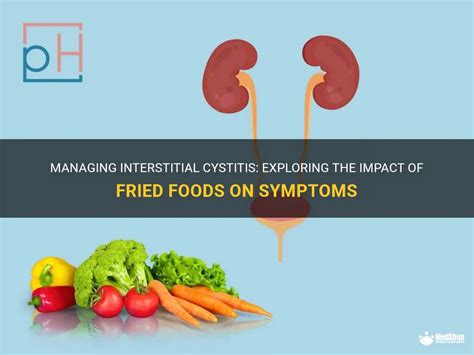 Managing Interstitial Cystitis Exploring The Impact Of Fried Foods On