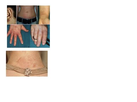 Eczemapptx Eczemapptx