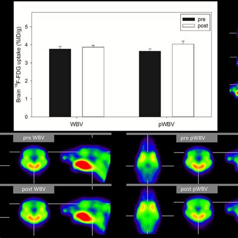Overview Of The Average Brain ¹⁸f Fdg Uptake In Idg Bar Chart Pre Download Scientific