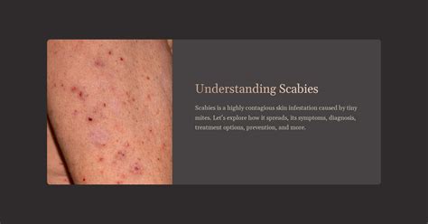 Understanding Scabies
