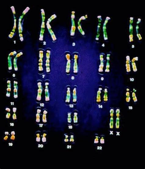 染色体 搜狗百科