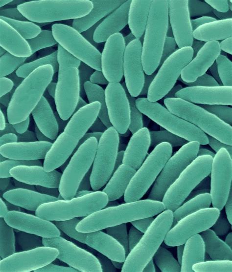 Pseudomonas Syringae 2 Photograph By Dennis Kunkel Microscopyscience