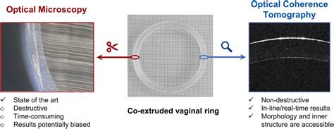 Optical Coherence Tomography Tutorial At Essie Jordan Blog