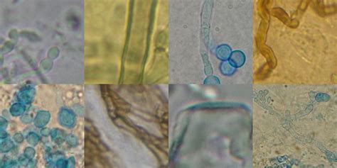 Github Balkarjunfungicv Fungi Image Classification Using Transfer Learning With Resnet And