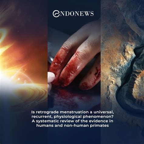 Seckin Endometriosis Center Posted On Linkedin
