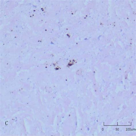 A 05 Hydrochloric Acid Differentiation Solution Differentiated For 6