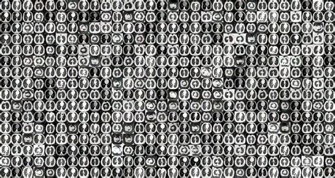 Enhancing Cancer Detection With Stylegan 2 Ada Towards Data Science