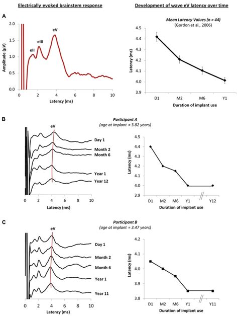 A Example Of An Electrically Evoked Auditory Brainstem Response Download Scientific Diagram