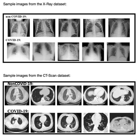 GitHub Iamrommelc COVID Classification Using Deep Learning Project Revolves Around The